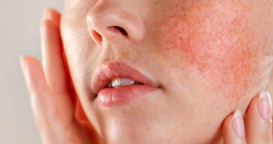 Shopping Guide - The Best Skin Routine for Sensitive Skin