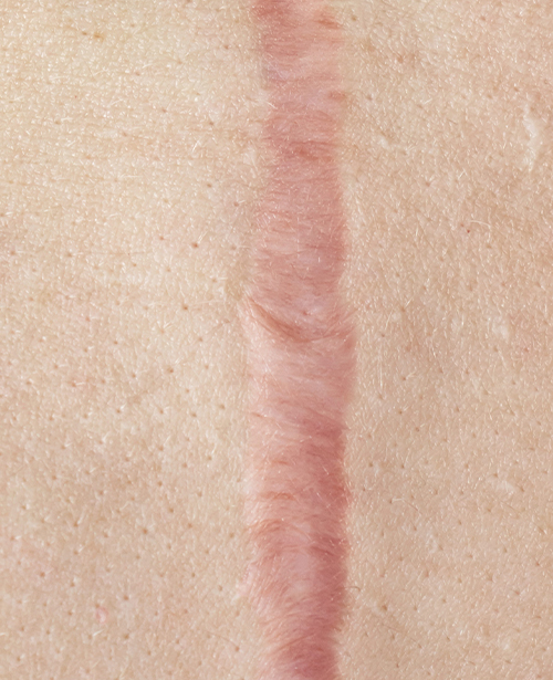 Shopping Guide - How to Clear Scars & Spots